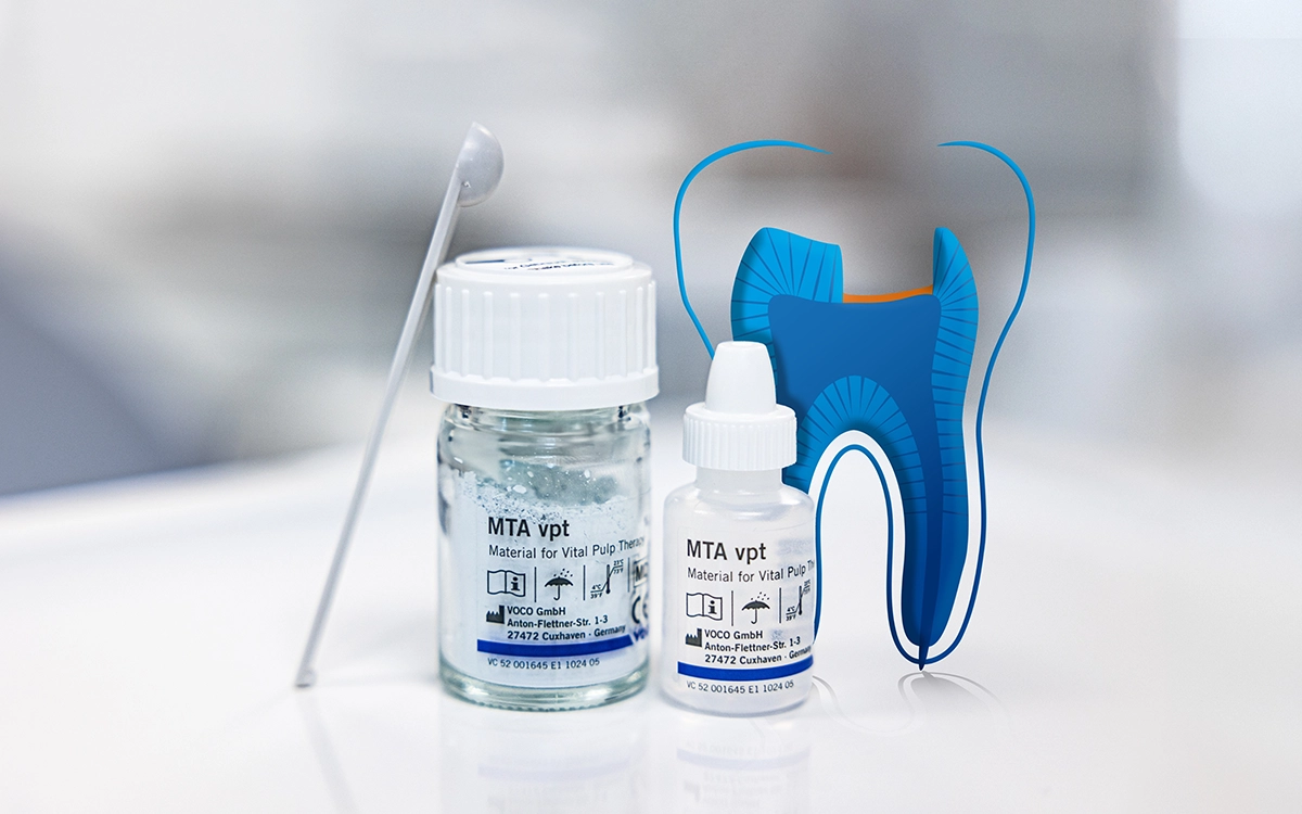 Vitalerhaltung der Pulpa für die tägliche Praxis | Dentalwelt