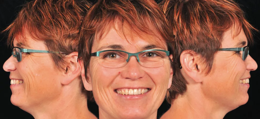 Erfolgreicher Einsatz der Root Membrane | Dentalwelt