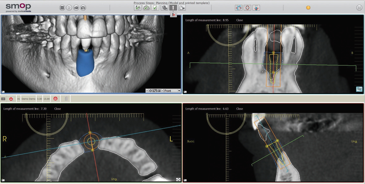 Straumann Competence Center Allografts | Dentalwelt