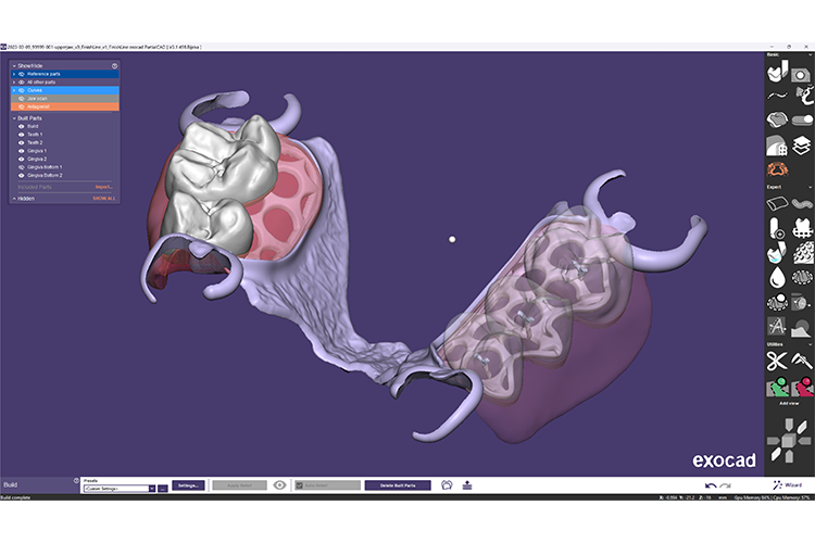 exocad PartialCAD 3.1 Rijeka | Dentalwelt